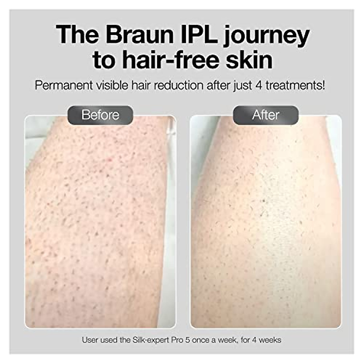 Braun IPL Long-lasting Hair Removal System for Women and Men, NEW Silk Expert Pro 3 PL3221, Head-to-toe Usage, for Body & Face, Alternative to Salon Laser Hair Removal, With 3 Extra Caps
