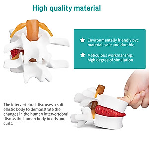 LVCHEN Disc Herniation Model - Human Lumbar Disc Herniation Spine Model 1.5X Intervertebral Disc Model Anatomical Vertebrae Disc Model with Elastic Software
