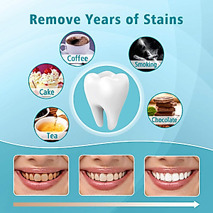 Teeth Whitening Gel, DOUCEUR 3pcs Teeth Whitening Pen Teeth Bleaching Whitening Teeth, No Sensitivity and Painless