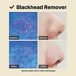 MAKEPREM Safe me. Relief Moisture Cleansing Oil 7.1 Fl Oz Naturally-Derived Ingredients PHA Formula Makeup Remover Pore Cleansing Blackhead Removal Hypoallergenic and Clinically Tested Oil Cleanser