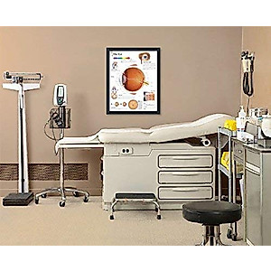 Set of 2 Framed Medical Posters The Eye and Understanding Glaucoma 22"x28" Wall Diagrams