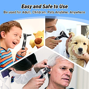 Scian Otoscope - Ear Scope with Light, Ear Infection Detector and Pocket Ear Checker Kit with 3X Magnify Lens, Suitable for Kids, Adults, Doctors, Pets(Black)