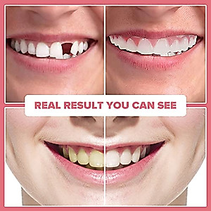 Fake Teeth, 2 PCS Dentures Teeth for Women and Men, Dental Veneers for Temporary Teeth Restoration, Nature and Comfortable to Protect Your Teeth and Regain Confident Smile, Natural Shade