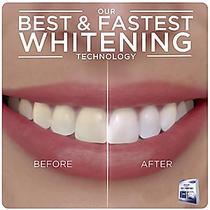 Crest 3D Whitestrips with Light, Teeth Whitening Strip Kit, 20 Strips (10 Count Pack)