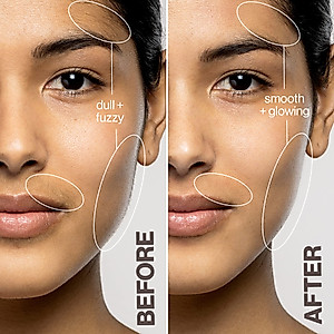 DERMAFLASH LUXE plus Device, Anti Aging, Exfoliation, Hair Removal, and Dermaplaning Tool with Sonic Edge Technology and 4 Weeks of Treatment, Blush