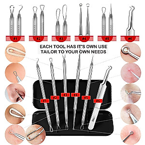 Blackhead Extractor, 6 Pack Pimple Popper Tool Kit for Removing Blackhead, Whitehead, Pimple, Acne, Zit, Comdone, Pores, Fat Granules on Nose, Face - with Organized Case