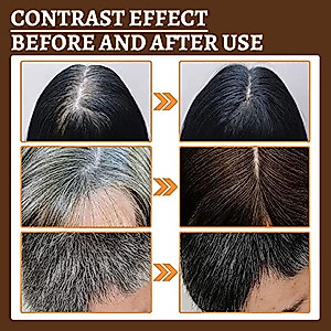 DARKA Anti-Greying Hair Serum, Hair Darkening Serum, Organic Ganoderma Nutrient Hair Grey Reverse Essence, Darken Your Hair Naturally Without Harming Them (3PCS)