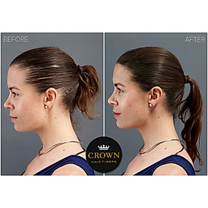 CROWN Hair Building Fibers (28g) - Instantly Cover Fine & Thinning Hair for a Thicker, Fuller Look - A Natural Keratin Concealer - 13 Shades for Men & Women - Black