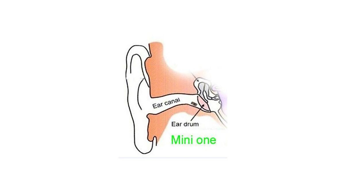 COOMAX Mini Spy Earpiece: Discreet Communication Device