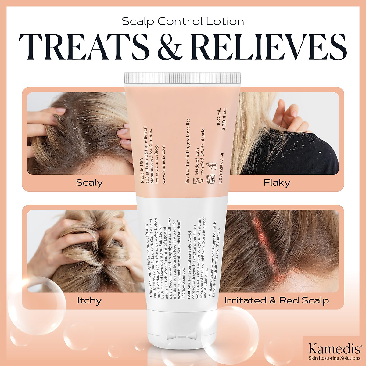 KAMEDIS Moisturizer Scalp Leave-On Botanical Lotion. For Dandruff, Dry, Itchy, Flaky, Seborrheic Dermatitis, Psoriasis and Sensitive Scalp Skin. Over-Night Head Mask, Parabens Free. 3.38 Fl Oz.