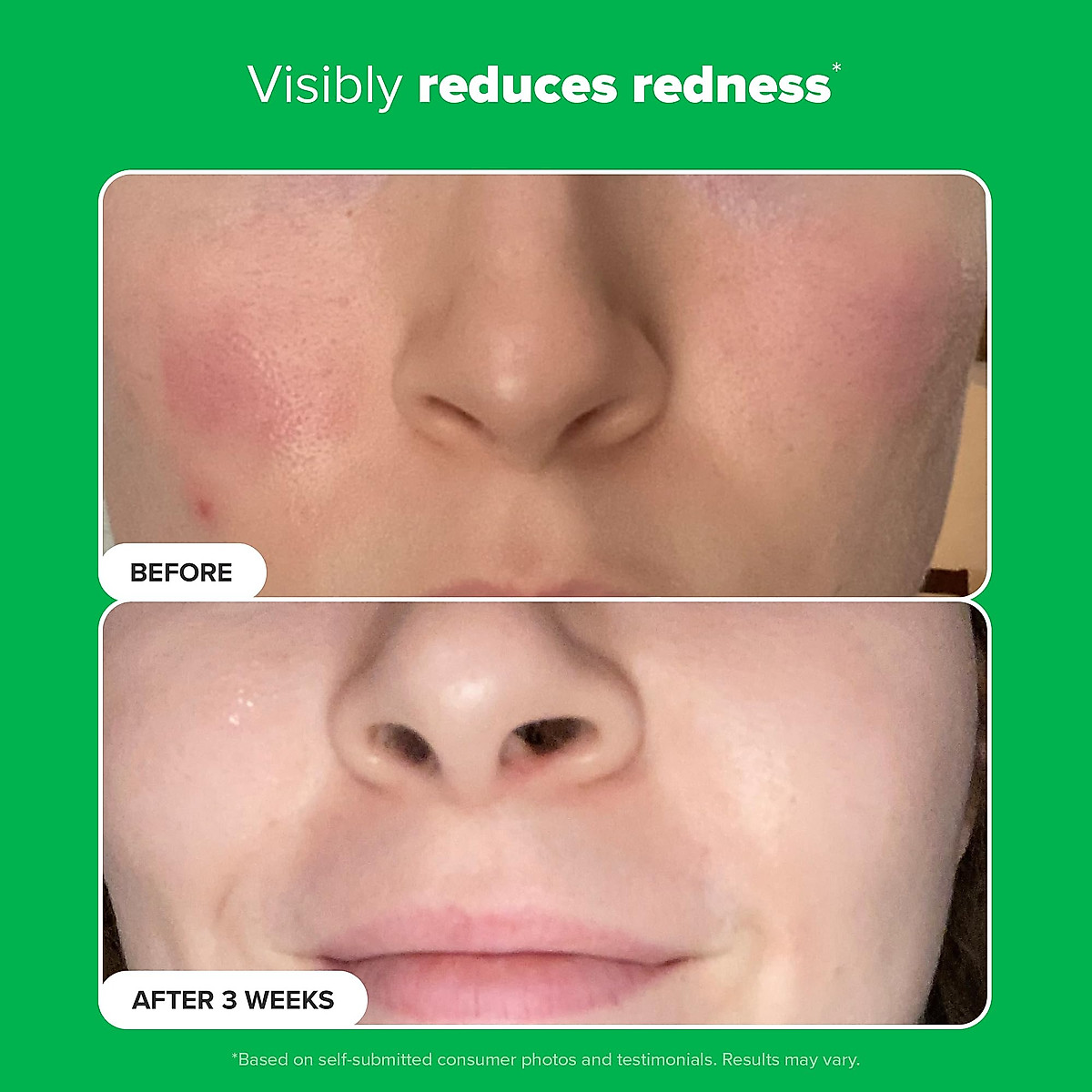 Paula’s Choice BOOST 10% Azelaic Acid Booster Cream Gel, Oil-Free Serum Fades Discoloration & Post-Blemish Marks, with Licorice Extract & Salicylic Acid, Fragrance-Free, 0.17 Fl. Oz.