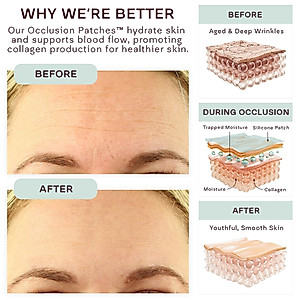 Dermaclara Forehead Patch - Forehead Wrinkle Patches for Face Overnight, Silicone Patches, Reusable Treatment for Wrinkles, Repair & Restore, Up to 30 Uses - 1 Patch