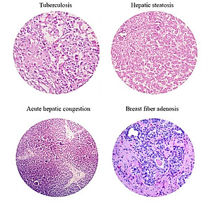 50Pcs/Set Human Pathology Slides Set Pathology Histology Prepared Microscope Slides