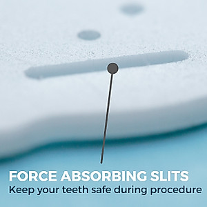 SISU Intuguard Custom Fit Intubation Mouth Guard for Dental Protection During Surgical Procedures