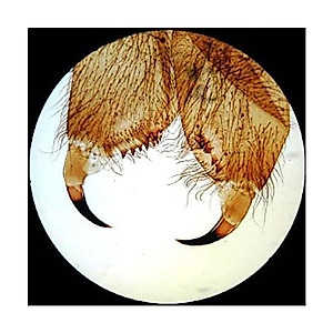 AmScope PS50A Prepared Microscope Slide Set for Basic Biological Science Education, 50 Biology and Pathology Slides, Includes Fitted Wooden Case