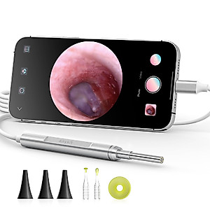 Ear Specula Set for Anykit Digital Otoscope, Bag of 100 Pices, Replacement Otoscope Tips, Ear Speculum