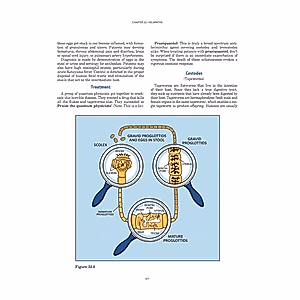 Clinical Microbiology Made Ridiculously Simple: Spiral Bound Color Edition