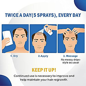 5% Minoxidil Hair Growth Spray For Men and Women 100Ml Hair Regrowth Treatment Serum For Stronger Thicker Longer Hair Help to Stop Thinning and loss hair 2 Month supply