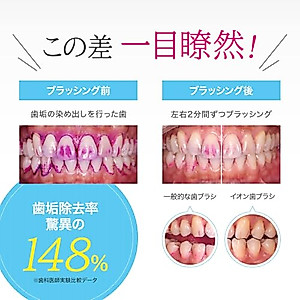 Kisuyu Ion Toothbrush Superfine Compact Body Usually