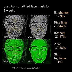 Aphrona Led Face Mask Light Therapy, Halo Led Light Therapy Facial and Neck Skin Care Mask, Blue Light Red Light for Acne Wrinkle Reduce, New Generation Face and Neck Photon Mask