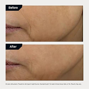 Revision Skincare D·E·J Face Cream®, Advanced Anti Aging Moisturizer, Lifting and Firming, Antioxidant Rich, 1.7 oz