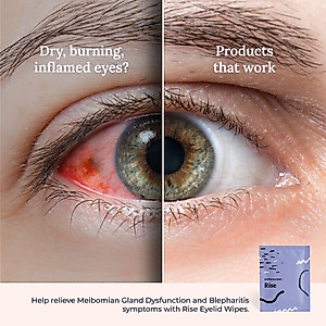 CorneaCare Rise - Eyelid Wipes, w/Tea Tree Oil & Hyaluronic Acid | Eyelid Wipe | Dry Eye Relief | Eye Wipes for Dry Eyes | Travel Ready | 30 Count | FSA & HSA Eligible