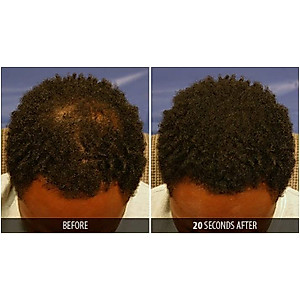 Dr. Yates MD Keratin Fiber Hair Enhancer (Dark Brown)