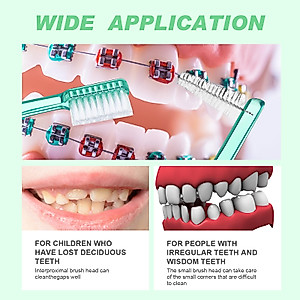 6 Pieces Orthodontic Toothbrush Braces Toothbrush with 6 Pcs Head Protection Cover Double-Ended Interdental Brush V Trim End for Braces Teeth Detail Cleaning 4 Colors