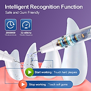 VVHOMIFE Dog Teeth Cleaning Kit-Dog Tooth Plaque Remover-Ultimate Pet Dental Care Kit - Ultrasonic Teeth Cleaner and Plaque Remover for Dogs | Complete Oral Hygiene Solution-White