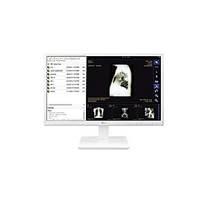 LG 24” 24CK560N-3A All-in-One FHD IPS Thin Client for Medical & Healthcare with Fanless & Ergonomic Design