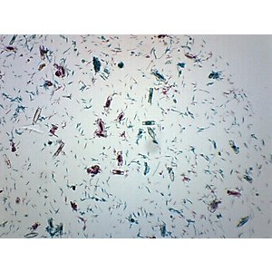 EISCO 10PK Mixed Diatoms, Wholemount - Prepared Microscope Slides - Classroom Pack, 10 Slides in Storage Case - Biology & Microscopy