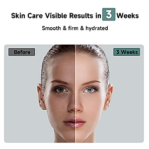 JOVS X IPL Hair Removal for Women and Men, 3-in-1 Hair Removal Device with Cooling System/Touch Screen/Unlimited Flashes, Painless Hair Remover Permanent at Home for Face Leg Arm Armpit Bikini Line