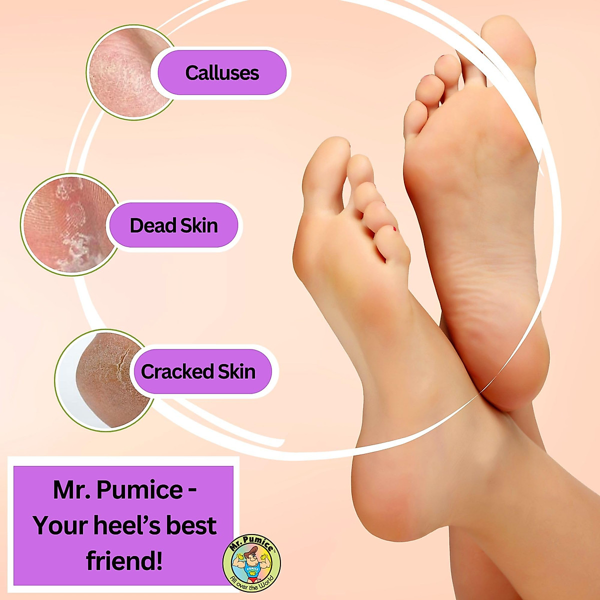 Mr. Pumice Purple PUMI Bar, Extra-Coarse Callus Remover, Pedicure Stone & Ped File Scrubber for Smooth Feet and Heels, 6 Pack