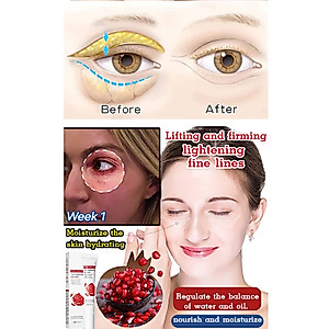 FIONEL Red Pomegranate Eye Cream, Pomegranate Vitamin C Eye Cream, Anti Aging Eye Cream, Wrinkle Eye Serum Cream Remove Dark Circles & Eye Bags, Moisturizer Eye Cream (3 pcs)