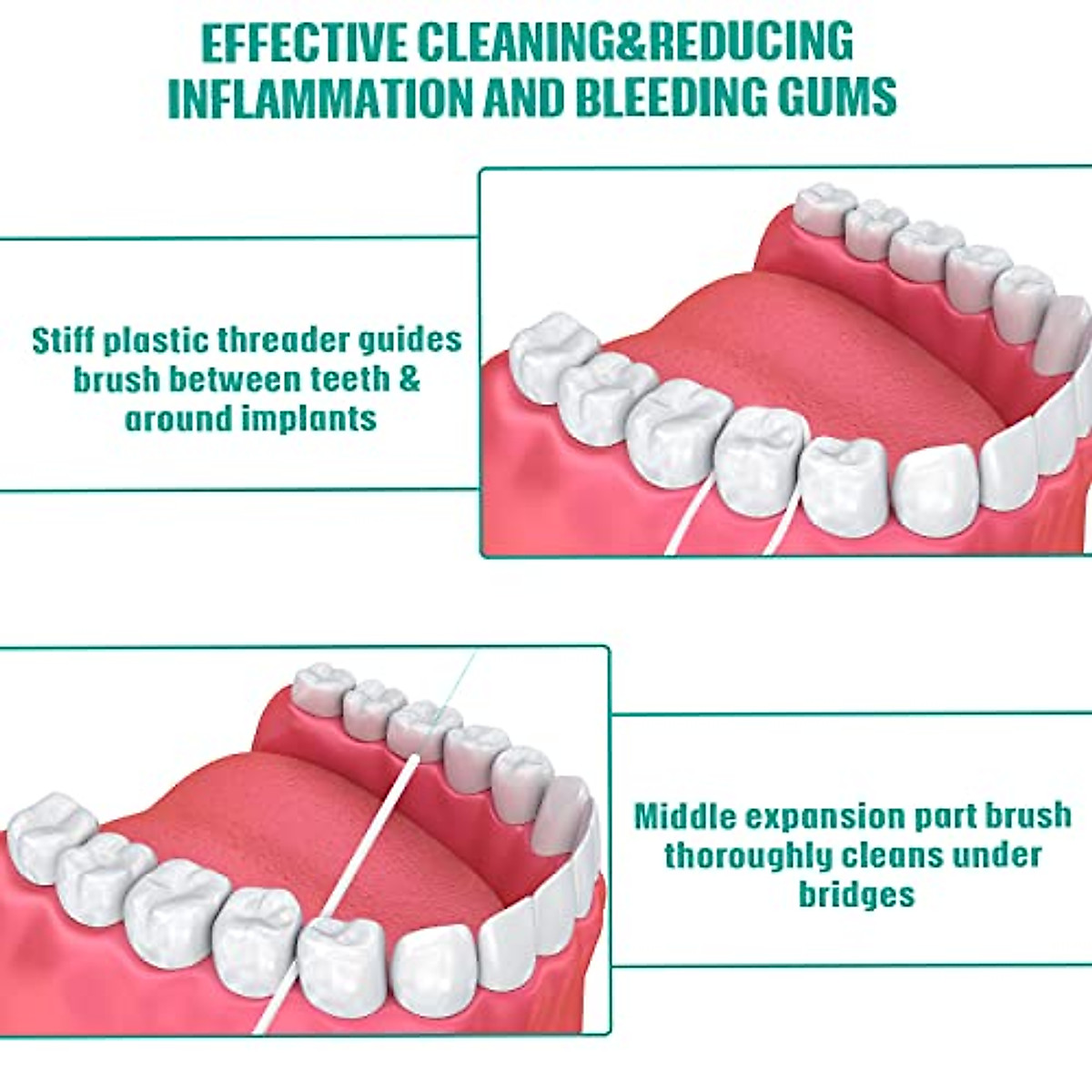 200 Pcs Floss Threaders for Bridges, 4 Packs Dental Floss for Braces, Bridges and Implants, Periodontal Disease Teeth Flossing