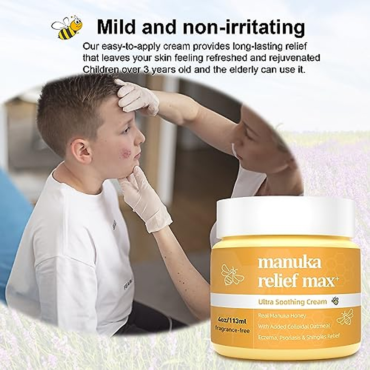 Eczema Psoriasis Manuka Relief Honey Cream, Hand Foot, Tinea Versicolor, Itchy Feet, Butt, Anal Itch, Scalp Dandruff, Bee Sting, Bites, Boil Cyst, Armpit, Adults Kids, Natural Organic Soothing