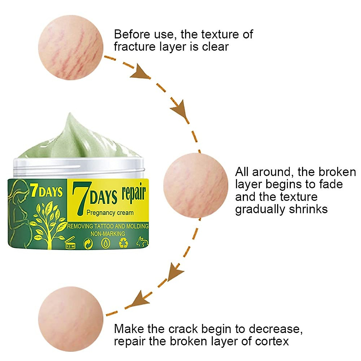 Hotiary Maternity Stretch Mark 7 Days Repair Cream Removing Tatoo Molding Non-marking Pregnancy Obesity Skin Postpartum Stretch Scar Body Marks Remover Smooth Skin Care 1.67 oz