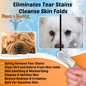 Multi-Purpose All-Natural Pet Finger Wipes, Organic, Safe, Non-Toxic Formulated Pre-Moistened Wipes. Remove Plaque & Whiten Teeth, Clear Ear Wax/Dirt Buildup, Soothe Dry Skin Folds, Remove Tear Stains