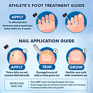 Ebanel Athlete's Foot Fungus Treatment Extra Strength, Antifungal Cream with Miconazole, Undecylenic Acid, Tea Tree Oil, Treats Skin Fungi Leading to Toenail Fungus, Promotes Healthy New Nail Growth