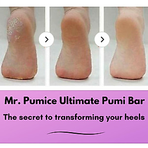 Mr. Pumice Ultimate PUMI Bar: 2-in-1 Dual-Grit (Medium + Coarse) Callus Remover, Pedicure Stone & Ped File Scrubber for Smooth Feet and Heels, (12-Count Display Box)