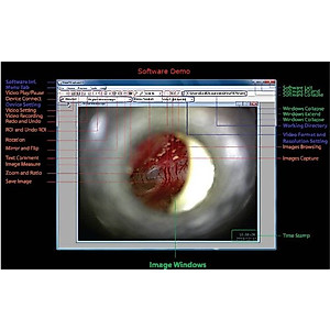 Firefly DE551 Wireless Veterinary Digital Video Otoscope