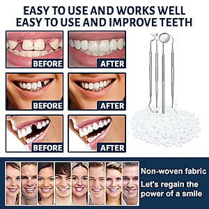 Tooth Repair Kit - Temporary Fake Teeth Replacement Kit with Dental Mirror Tools for Temporary Restoration of Missing & Broken Teeth Replacement Dentures