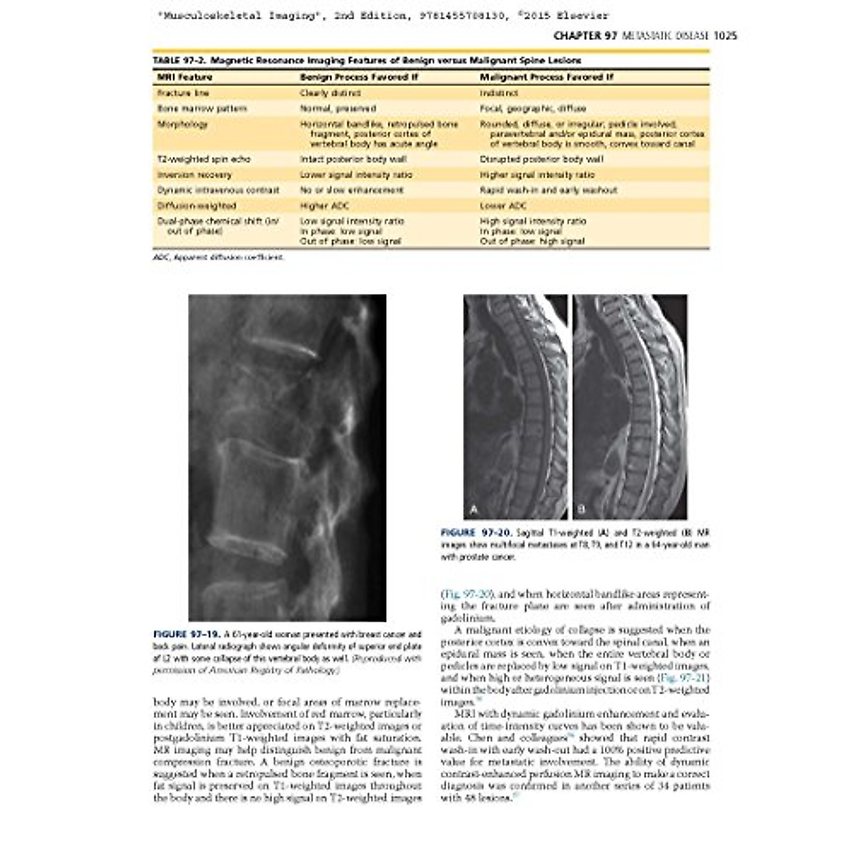 Musculoskeletal Imaging: Expert Radiology Series