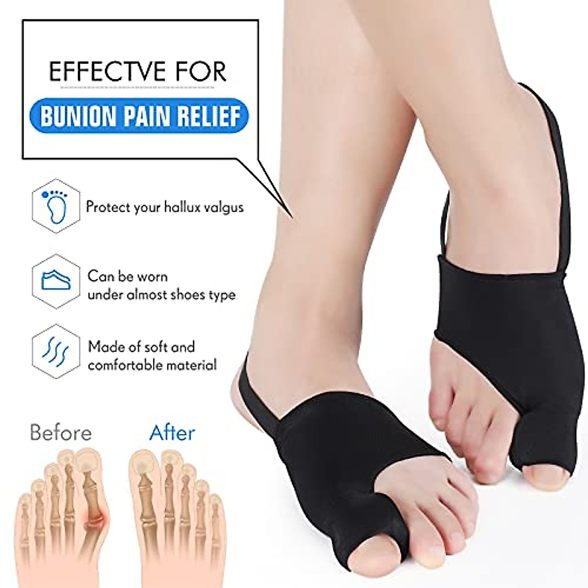 Bunion Corrector & Bunion Toe Separator, Orthopedic Bunion Splints Bunion Pads, Big Toe Separator Pain Relief, Non-Surgica Hallux Valgus Correction Treatment, Toe Straightener Bunion Socks, Day Night Support