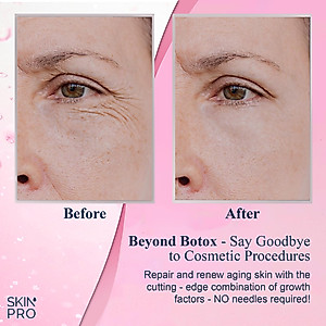 Skin Pro Skin Care Epidermal Serum for Face - PRP Facelift - IGF, EGF Serum - Serum for Face, Face Care, HGF Serum, Platelet-Rich Plasma Deep Anti-Wrinkle Serum with Jojoba Beads