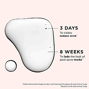 IT Cosmetics Bye Bye Breakout 2% Salicylic Acid Acne Treatment Serum, Helps Reduce Pimples in 3 Days & Fades Look of Post-Acne Marks in 8 Weeks, Facial Skin Care Product with 3% Lactic Acid - 1 fl oz