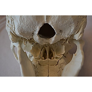 Wellden Medical Anatomical Adult Osteopathic Skull Model, 22-Part, Life Size, Bone Color