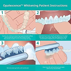 Opalescence at Home Teeth Whitening - Teeth Whitening Gel Syringes - 4 Pack of 35% Syringes - Mint