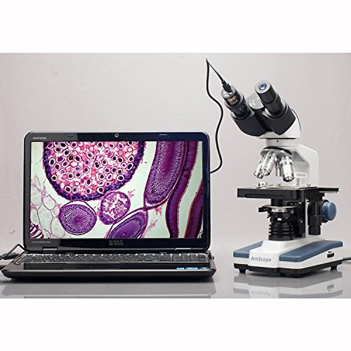 AmScope MD35 0.3MP Digital Microscope Camera for Still and Video Images, 40x Magnification, Eye Tube Mount, USB 2.0 Output, Includes Software