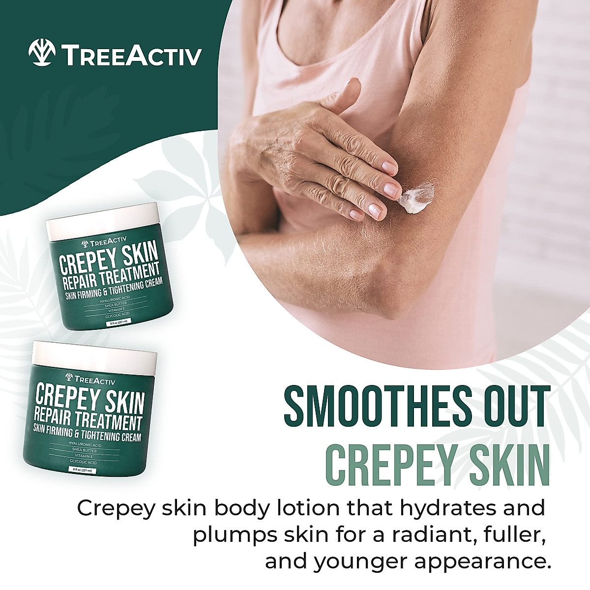 TreeActiv Crepey Skin Repair Treatment, 8oz, Firming Cream For Face and Neck, Skin Firming and Tightening Lotion with Hyaluronic Acid, Crepey Skin Treatment that Moisturizes Dry Crepe Skin, 500+ Uses